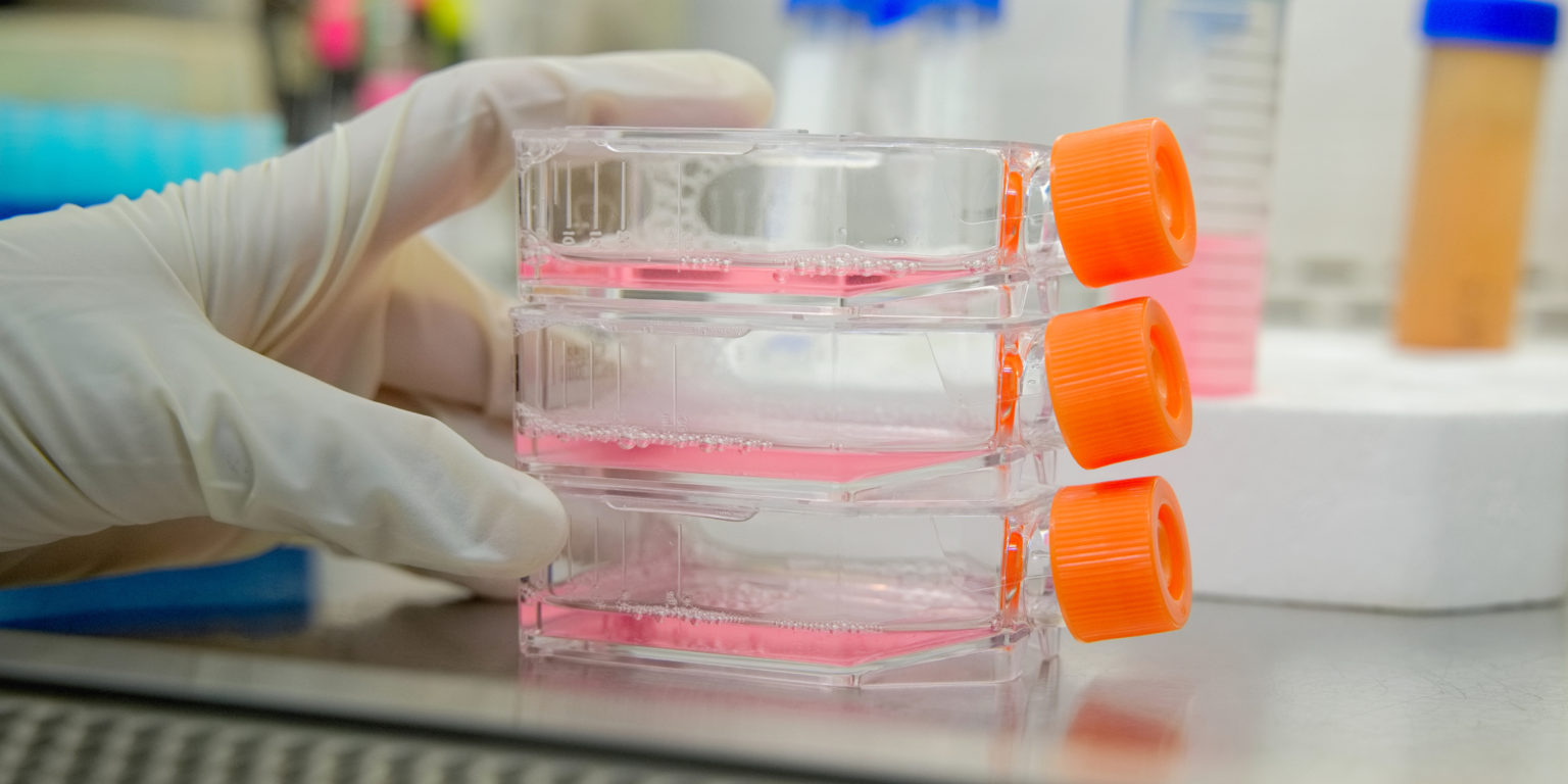 Your Media Choice Might Be Designing Your T-Cell Fate - Promega Connections