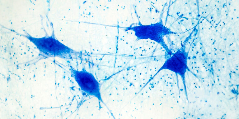 A Diabetes Drug, Metformin, Slows Aging in Male Monkeys - Promega ...